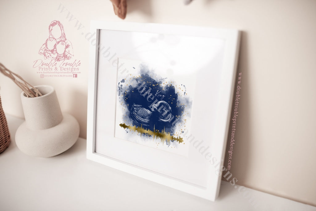 HEARTBEAT ULTRASOUND BABY SCAN SOUNDWAVES QR CODE – Double Trouble ...